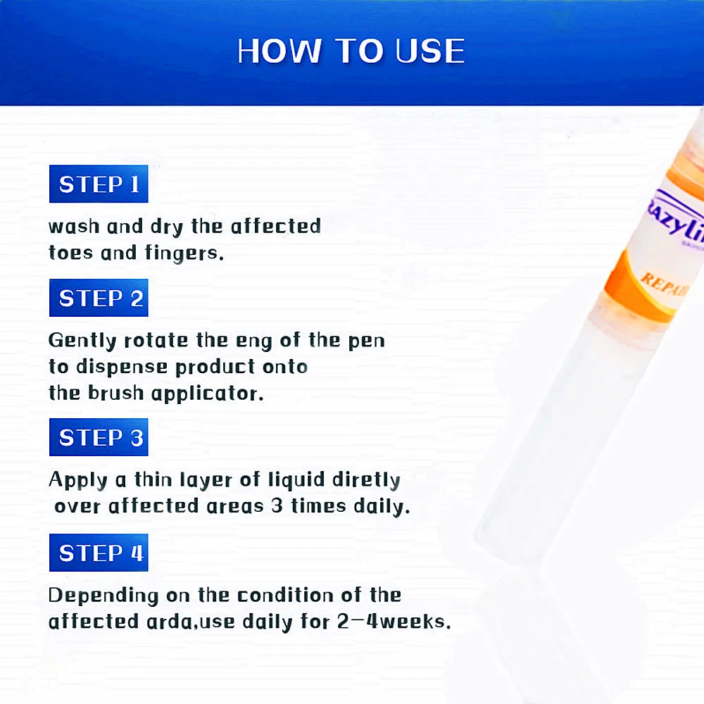 onychomycosis Anti Fungal Nail Solution Kill Fungus on Toenails ...