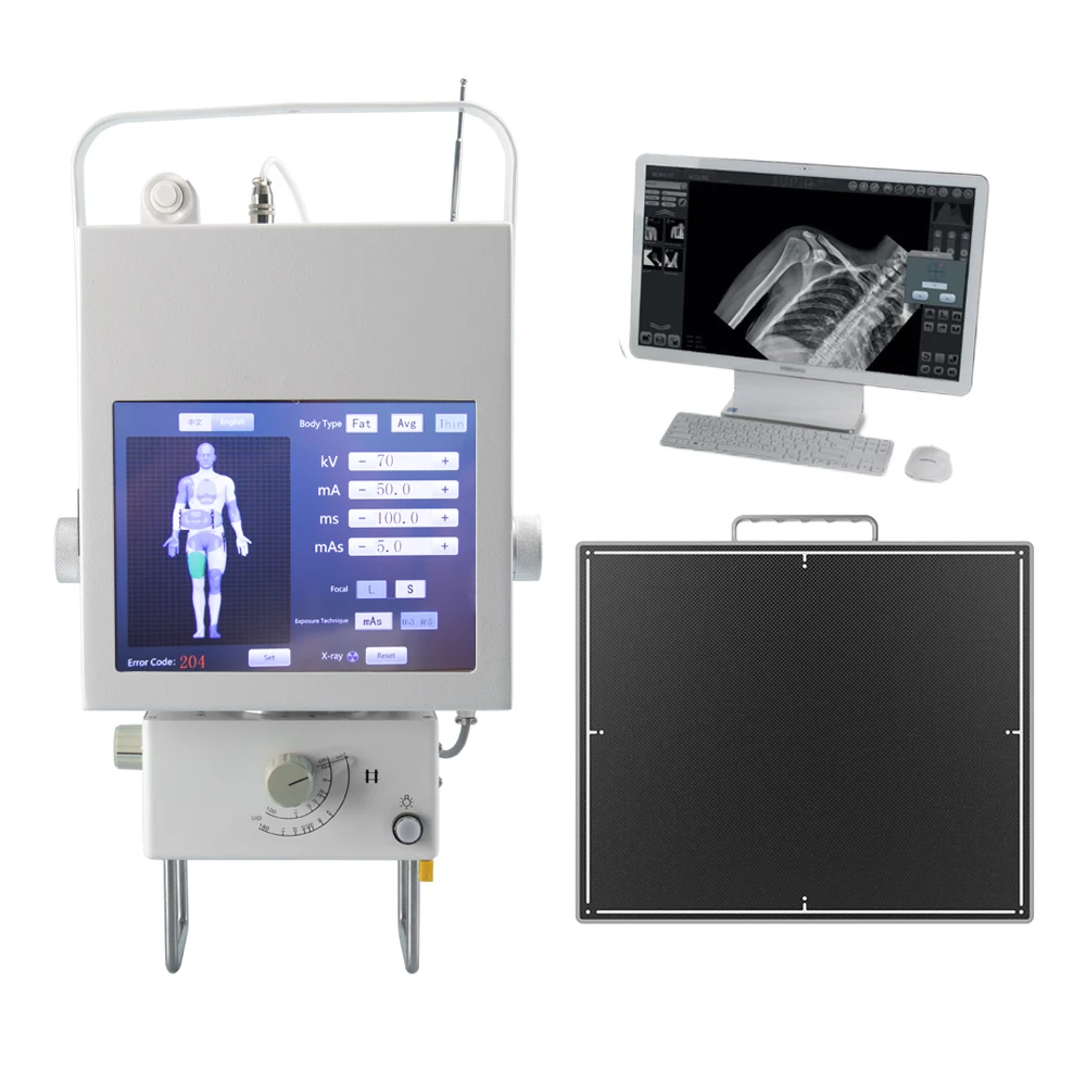 Portable X Ray Machine Stand For Mobile Digital X-ray Machine Mslpx15 ...