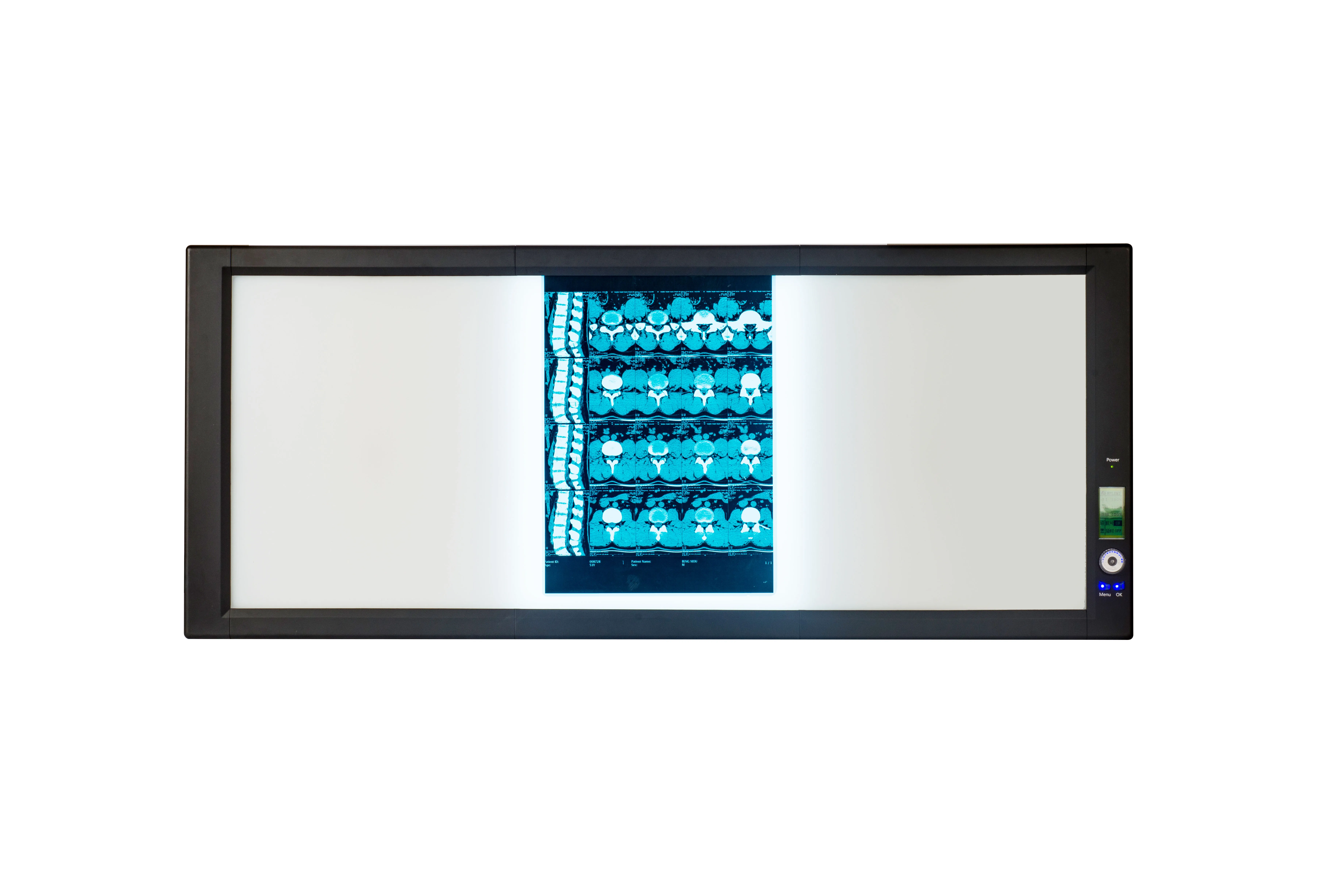 MSL X-Ray Film Viewer - Bright, Reliable LED Illumination