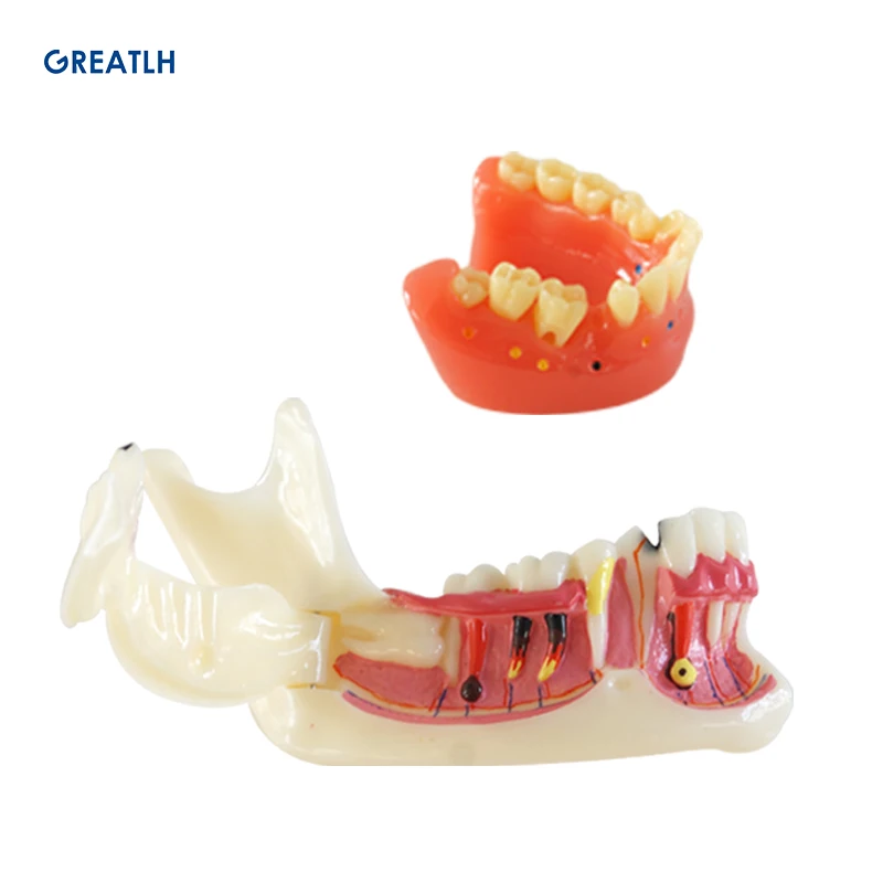 Dental Porcelain Oral Dental Porcelain Typodont Teeth Model Dental ...