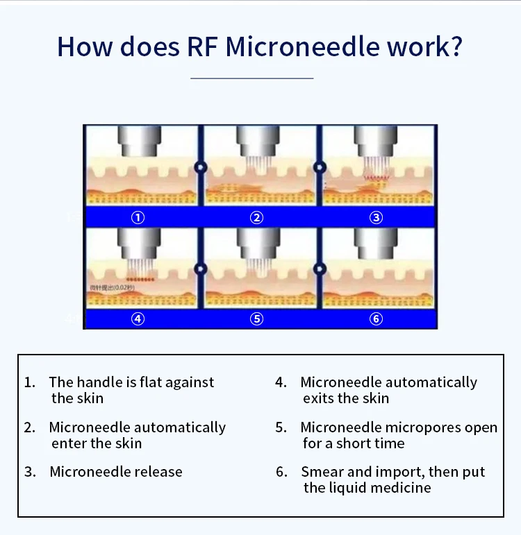 2023 Gold Microneedle Rf Wrinkle Removal Machine With Fractional RF ...