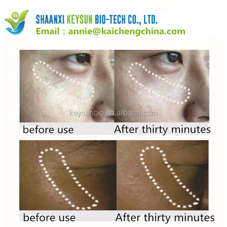 2020 New Product Skin Care Moisturizing Micro Needle Patch Dissolving ...