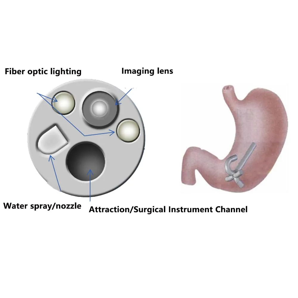 Medical Laparoscopy Tower Laparoscopic Instrument Laparoscopet Surgery ...