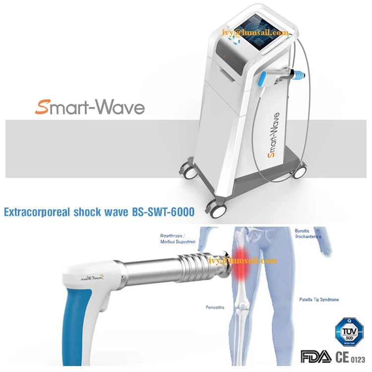 Extracorporeal Shockwave Therapy For Refractory Greater Trochanteric ...