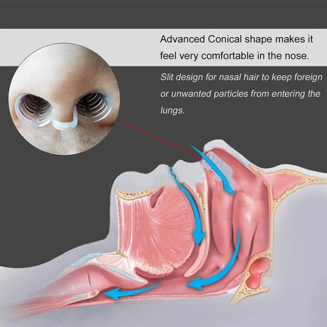 Anti Snoring Devices Snoring Solution Internal Nasal Dilator Nose Vents ...