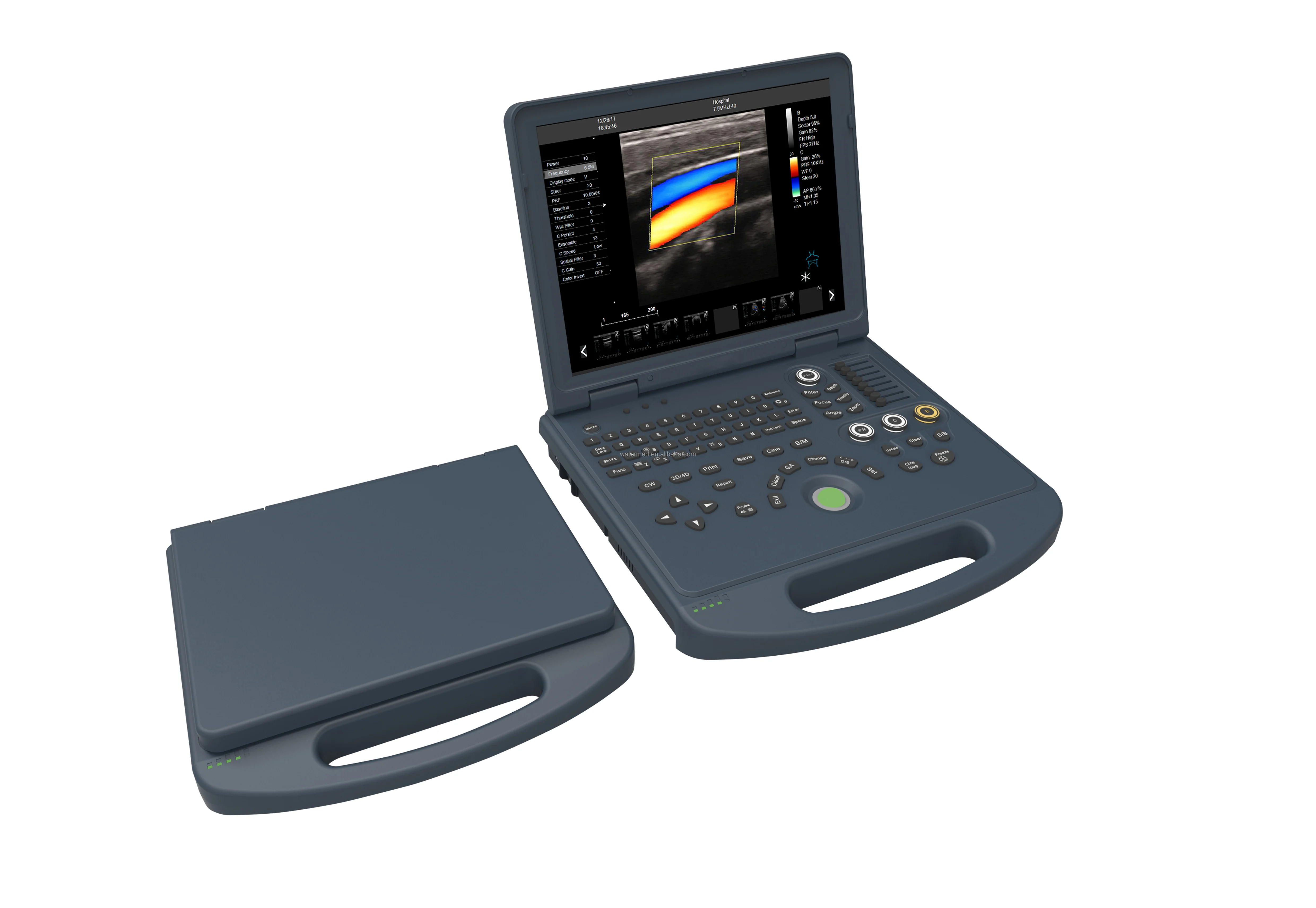4d Ultrasound Color Doppler Portable Ultrasound System Price - Buy 4d ...