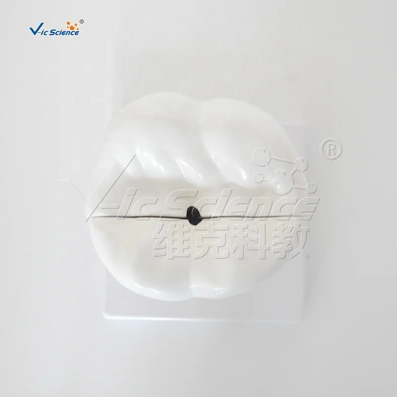 Human Teeth Anatomical Model Molar Tooth Attach With Caries Maxillary ...