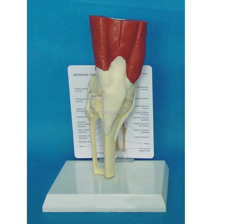 The Dissection Model Of Upper Limb - Buy The Dissection Model Of Upper ...