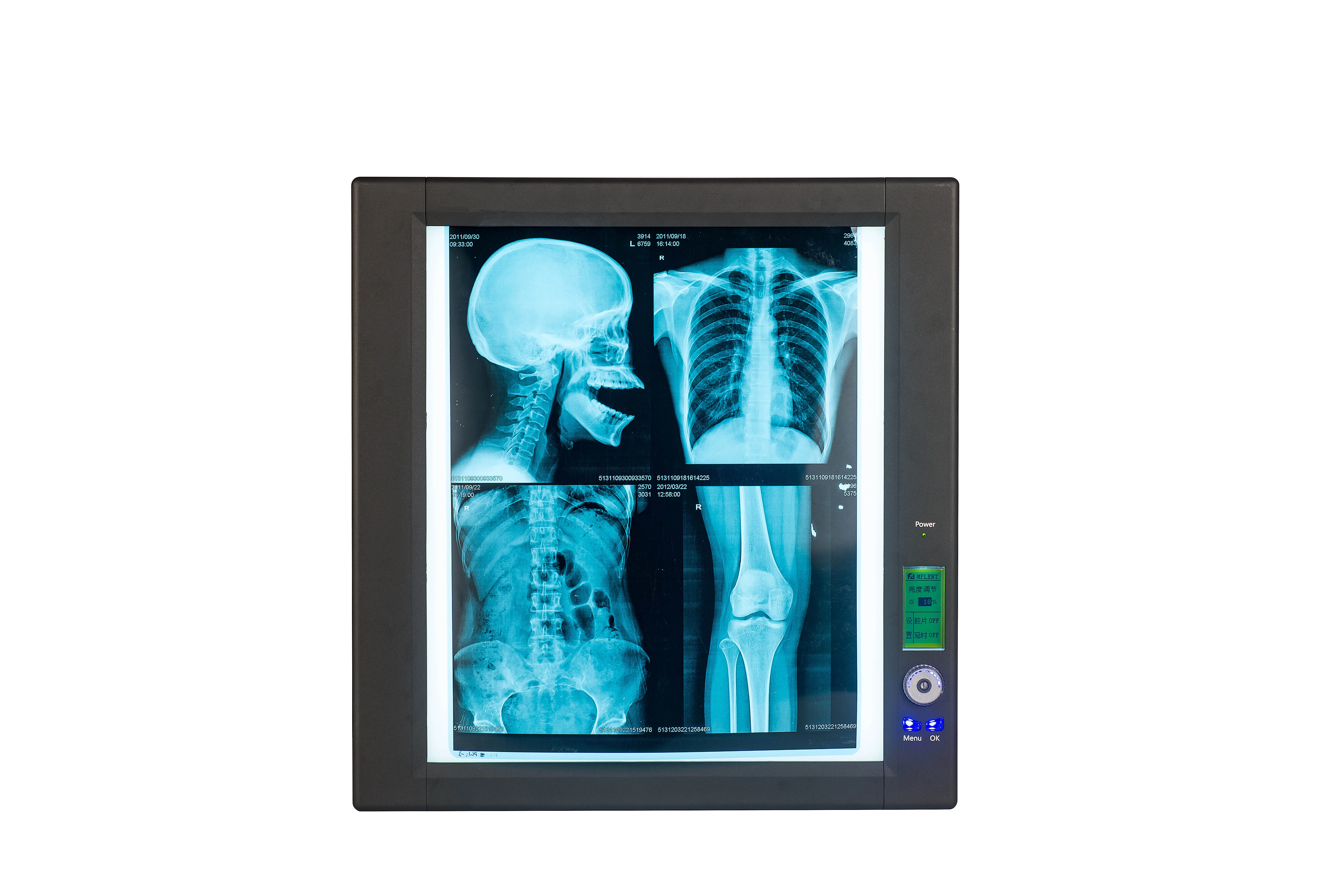 MSL X-Ray Film Viewer - Bright, Reliable LED Illumination