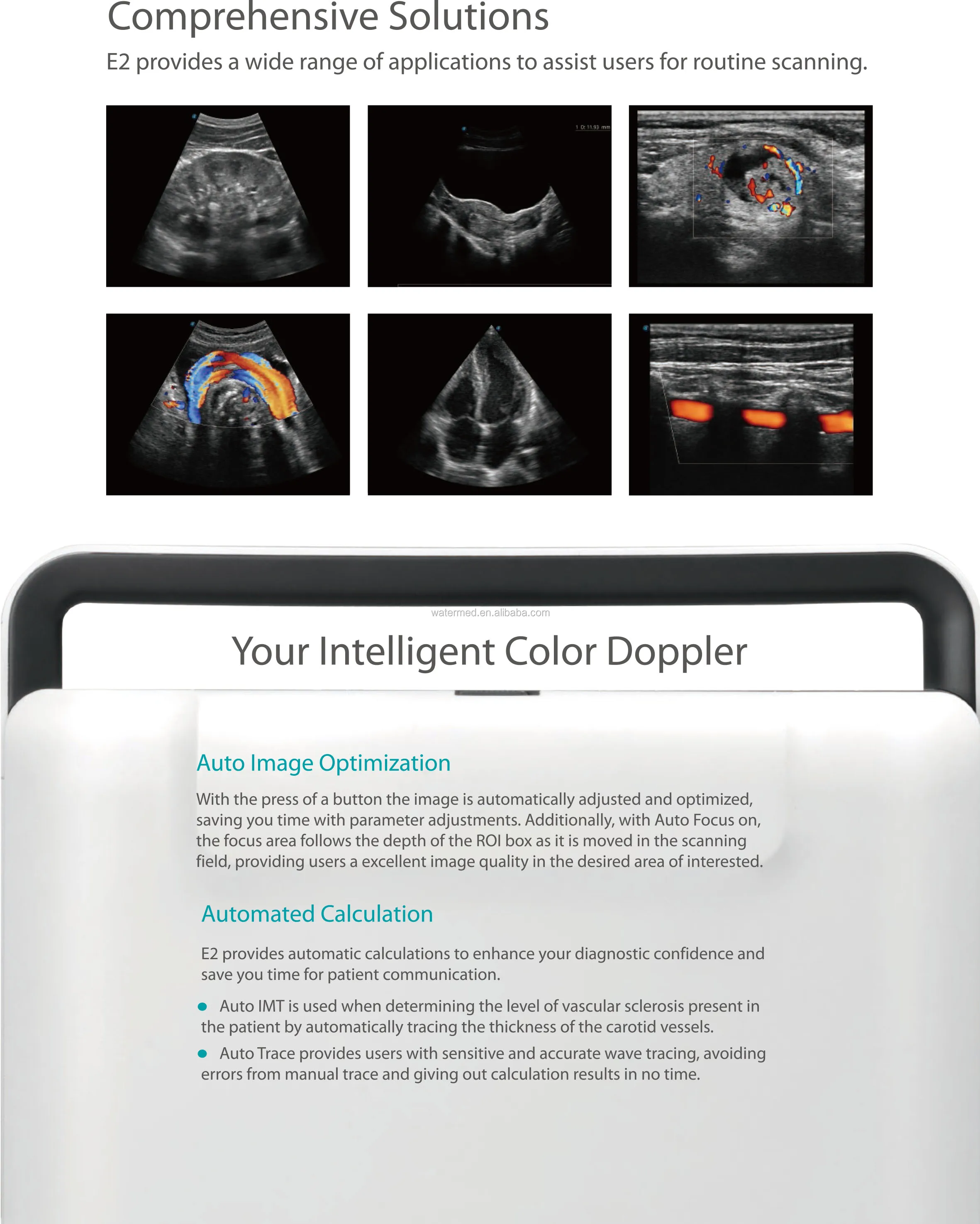 MSK Ultrasound TDI CW Color Sonoscape E2 E3 & Sonoscape E1 Usg
