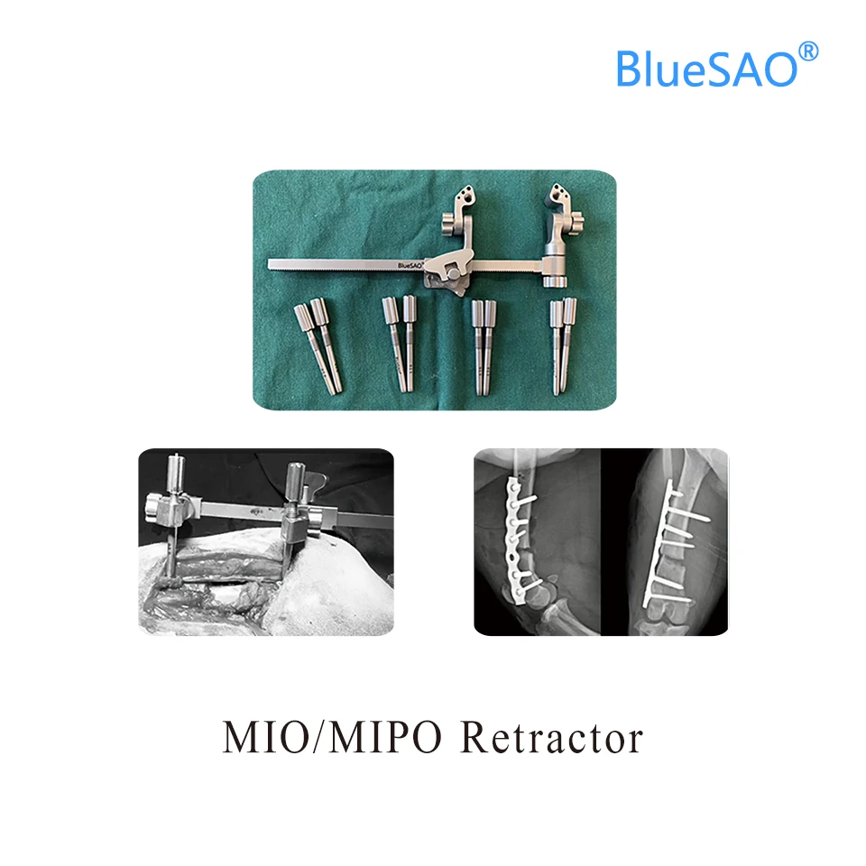 Bluesao Mio/mipo Retractor Mio:minimum Invasive Osteosynthesis Mipo ...