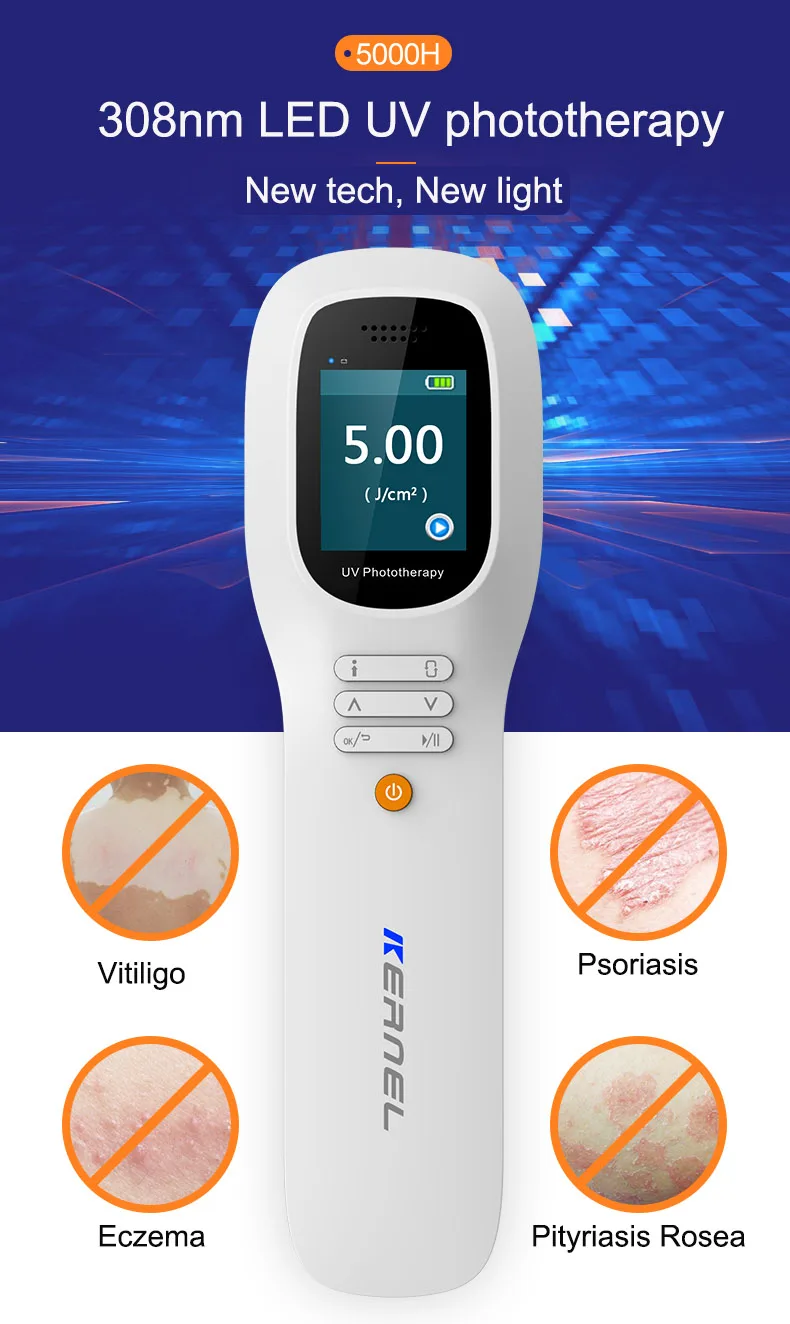 Kernel Kn-5000h Handheld Portable Led 308nm Uvb Light Therapy Machine For Targeted Treatment Of ...