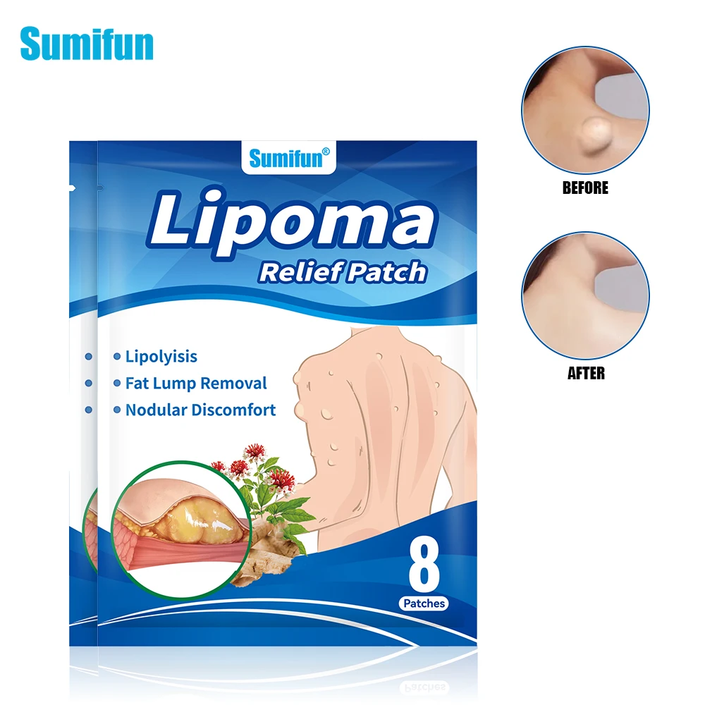 Natural Herbal Fat Lump Removal Lipoma Lumps Removal Patch Anti ...