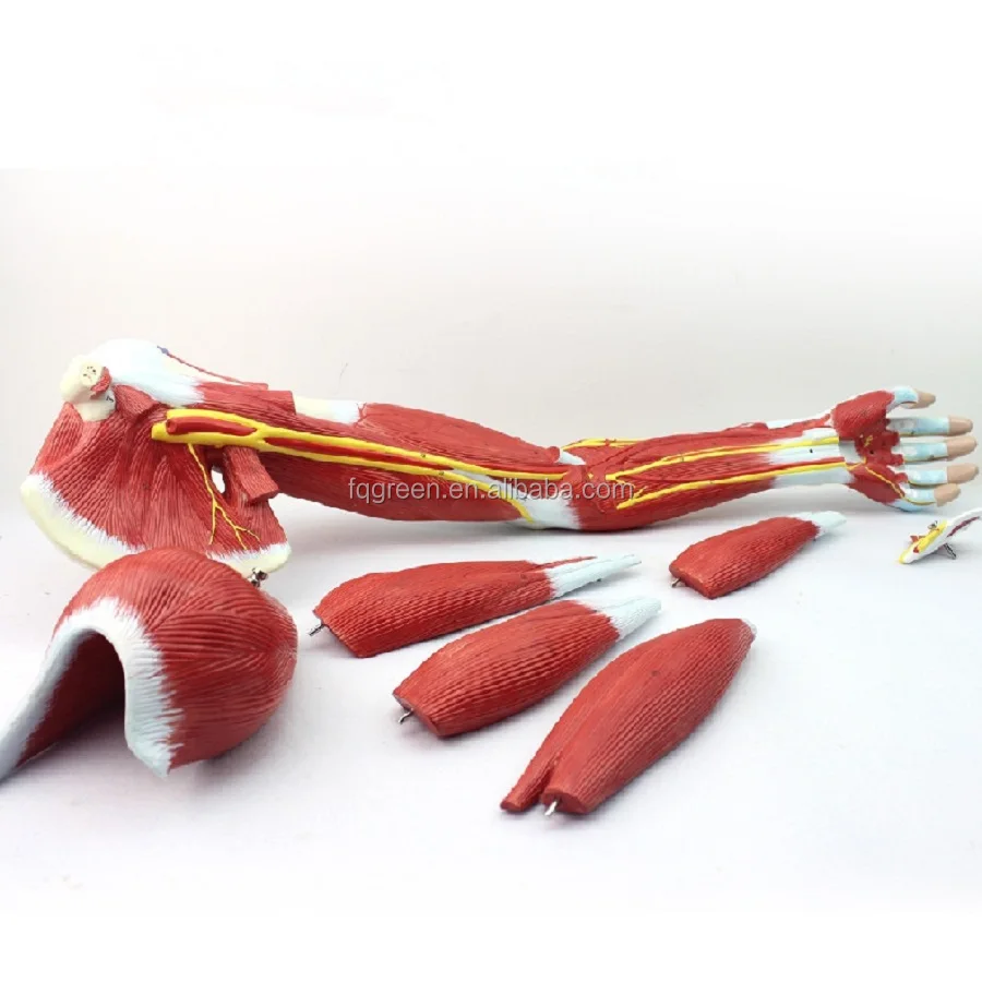 The Dissection Model Of Upper Limb - Buy The Dissection Model Of Upper ...