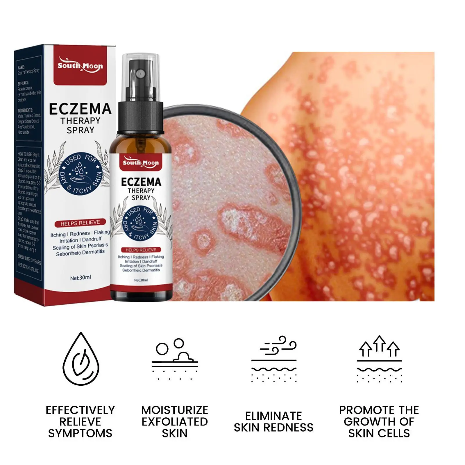 Hand Foot Scalp Eczema Tinea Anti-itch Rash Urticaria Desquamation ...