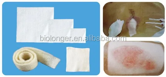 Alginate Dressing Definition Of Surgical Dressing - Buy Alginate ...