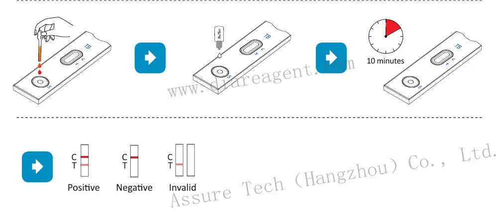 One Step Tb Whole Blood Rapid Diagnostic Test Kit - Buy Tb Rapid Test ...