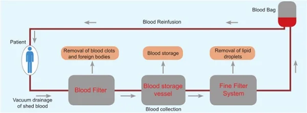Disposable Autologous Blood Transfusion Set With Ce - Buy Blood ...