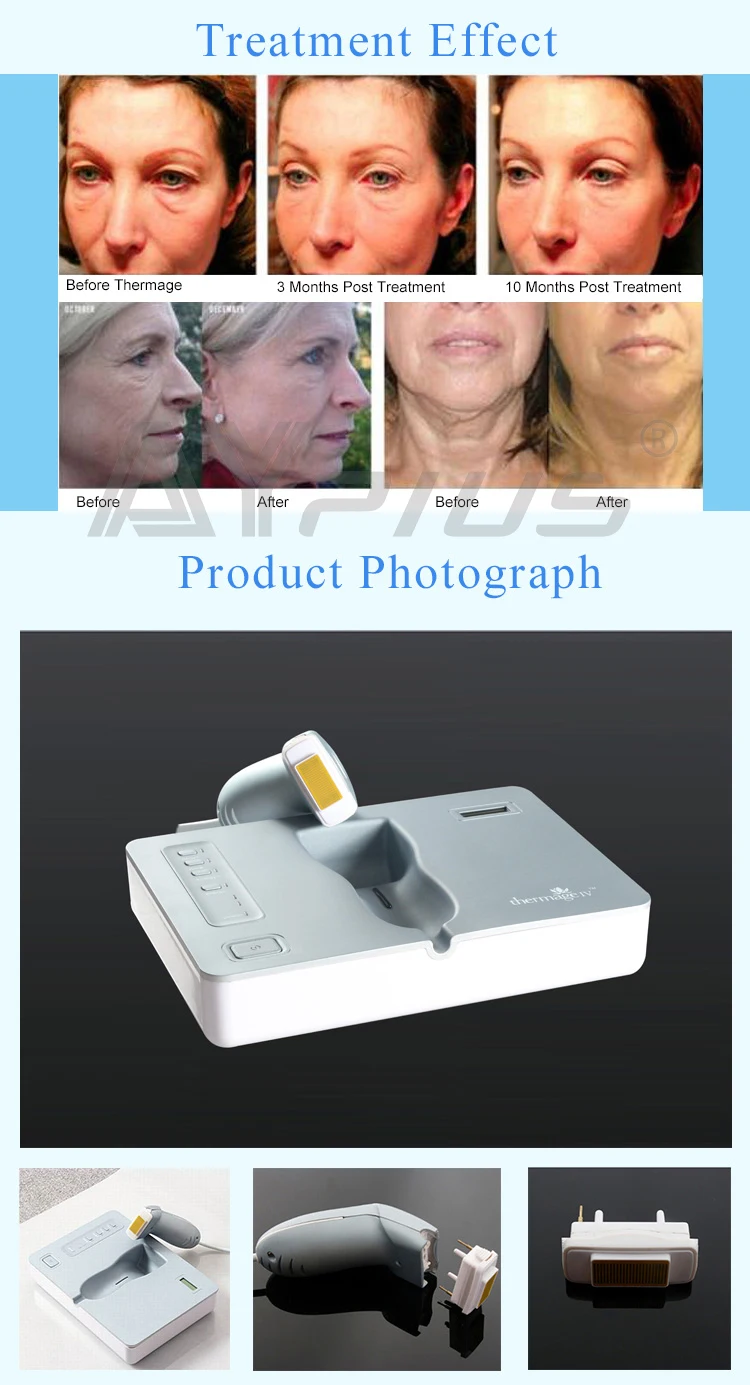 Ayj-t28 (ce) Hottest Dot Matrix Rf Beauty Machine Dot Matrix Rf - Buy ...