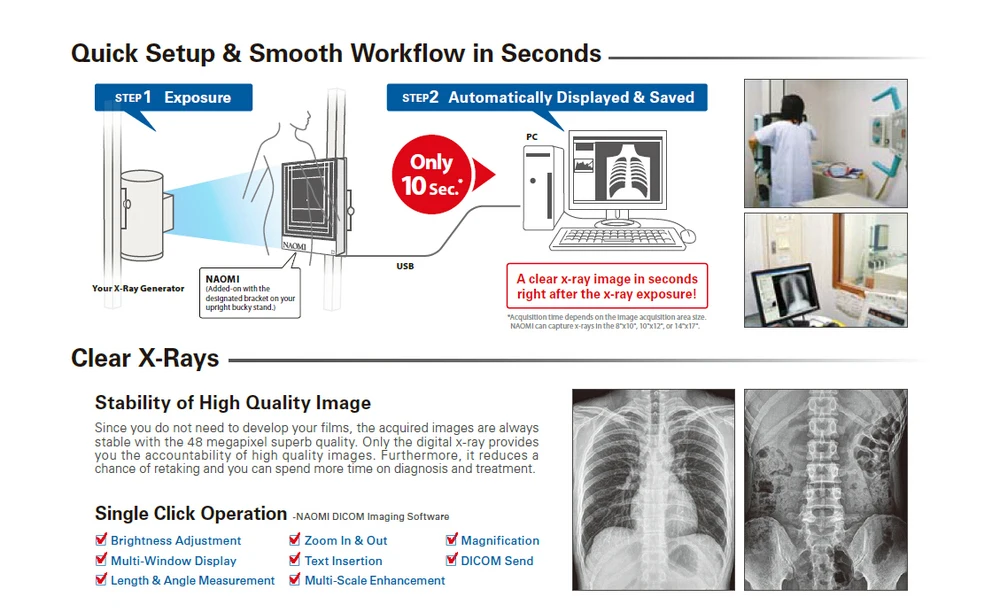 Direct Digital Radiography Ccd Imaging Sensor Naomi Ccd Digital Imaging ...