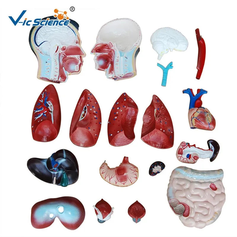 Medical Teaching 40 Parts 85cm Human Body Anatomical Torso Model - Buy ...