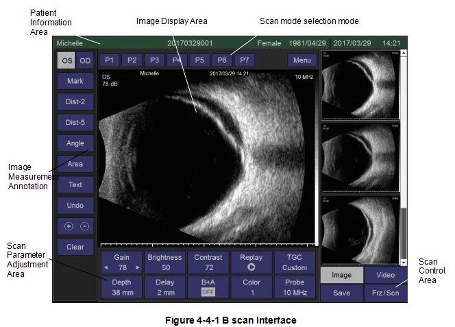 Handheld Led Touch Screen Ophthalmic A Scan And B Scan Ultrasound For ...
