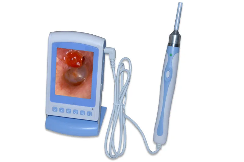 Eletronic Endoscope Handheld Digital Medical Usb Otoscope ...