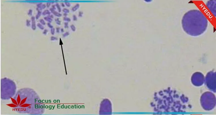 Fixed Set High Quality 14 Pieces Chromosome Microscope Prepared Slides ...