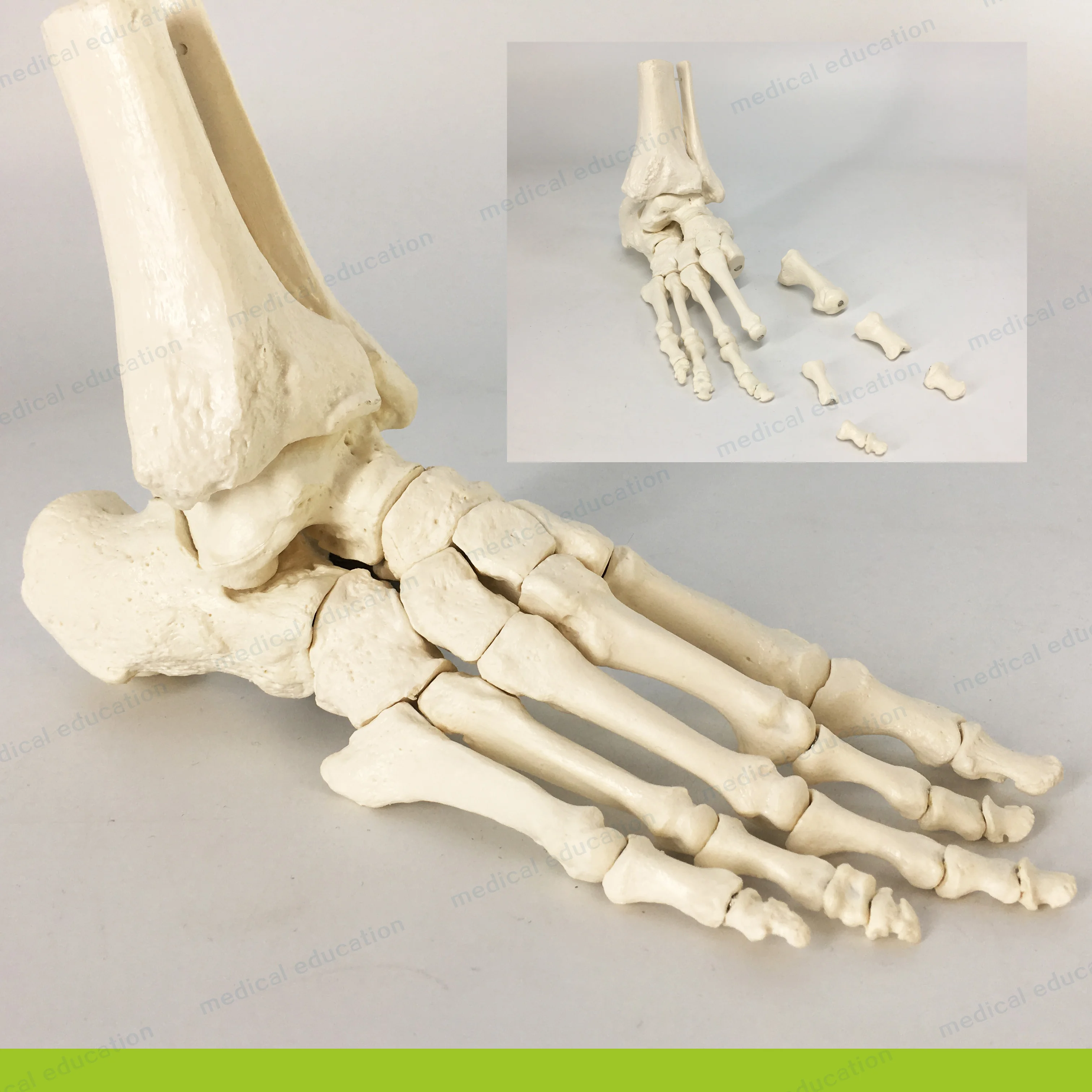 Skeletal Model Simulation Of Orthopaedic Specimens Of Foot,Ankle And ...