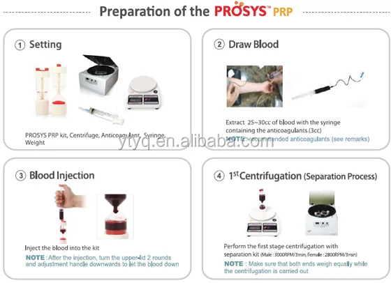 Platelet Rich Plasma Prp Centrifuge For Buffy Coat 20cc 30cc Prp Tubes ...