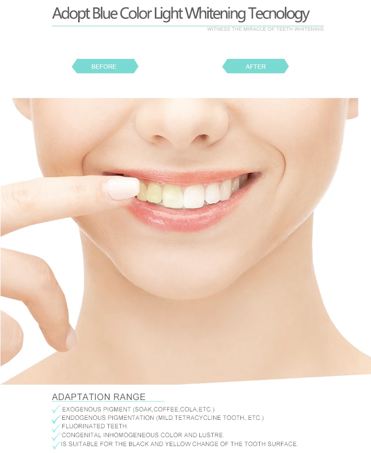 Professional Teeth Whitening Accelerator Light Lamp Bleaching Led Blue ...