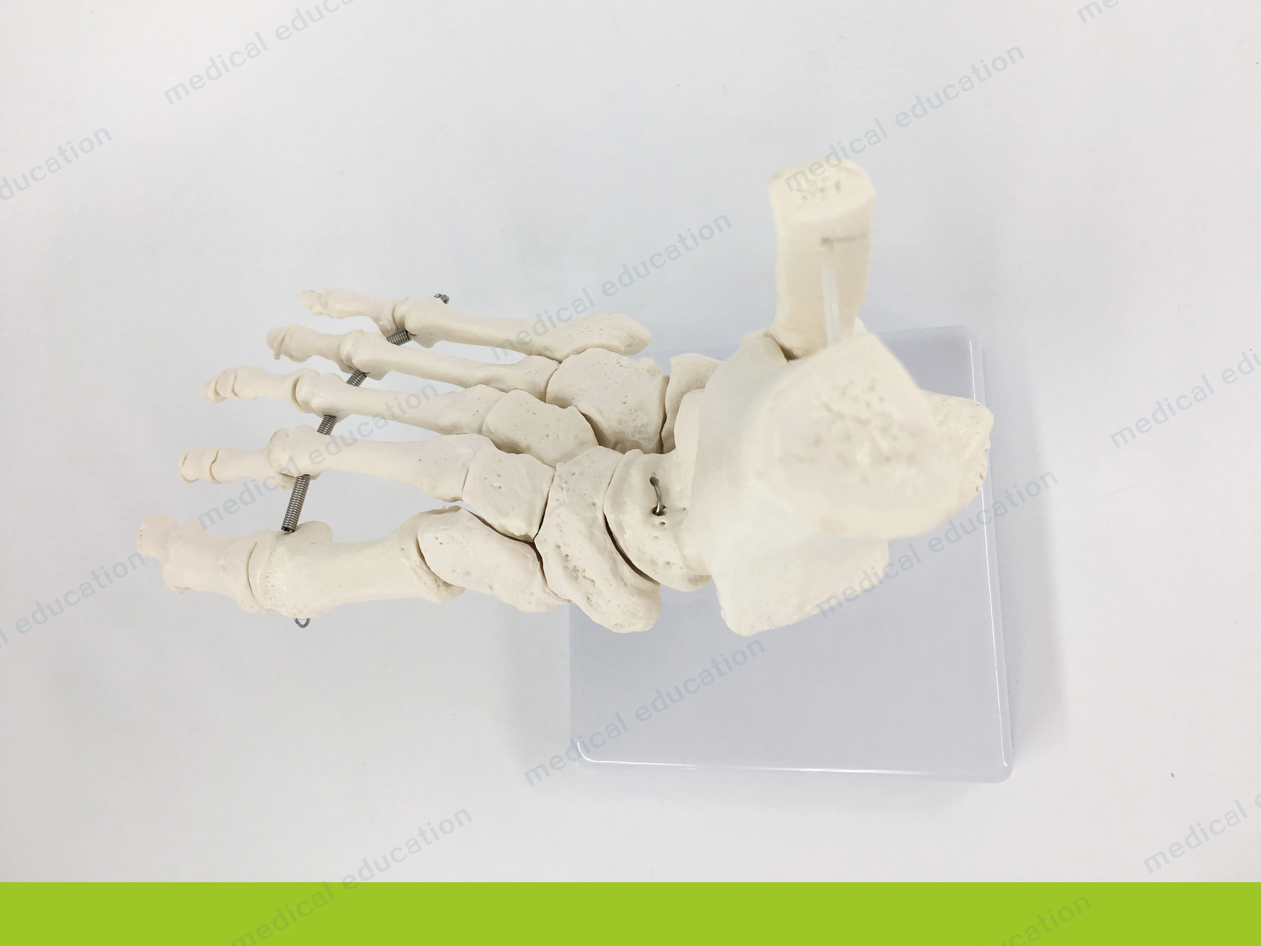Skeletal Model Simulation Of Orthopaedic Specimens Of Foot,Ankle And ...