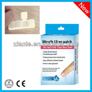 Mouth Ulcer Patch - Buy Mouth Ulcer Patch,Mouth Ulcer Patches,Mouth ...