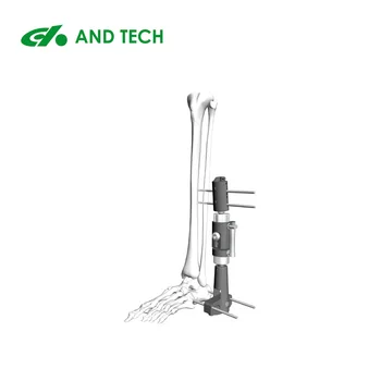 Orthopedic Surgical Disposable Ankle Fixator External Fixation - Buy ...