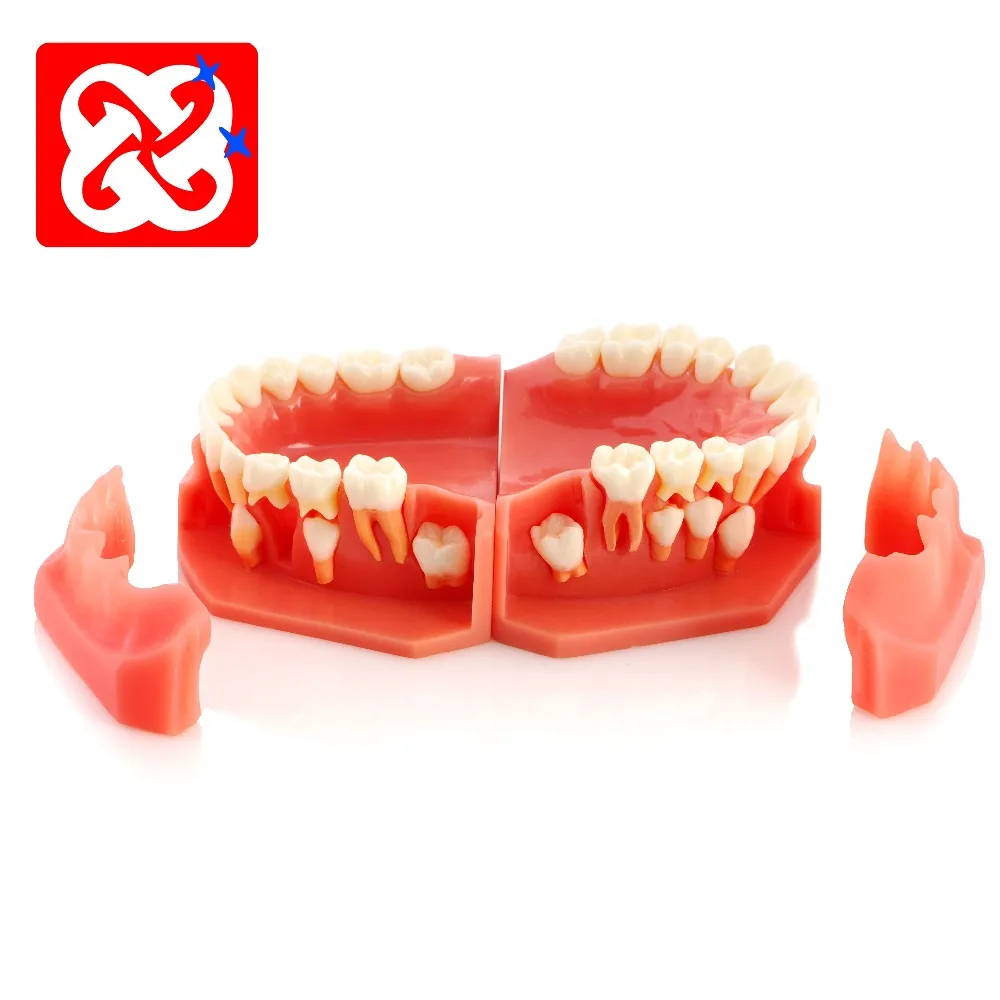 Standard Tooth Model /mix Dentition Demonstration Model - Buy Mixed ...