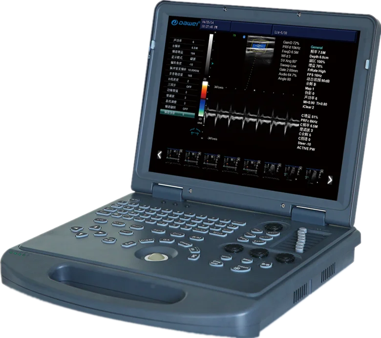 Echo Cardiography Doppler & Medical 3d Color Doppler Ultrasound System ...