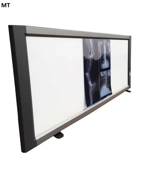 Portable Medical Led X Ray Negatoscope Triple Machine - Buy Medical X ...