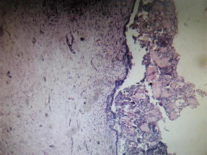 Lab Survey Medical Science Human Oral Teeth Pathological Prepared ...