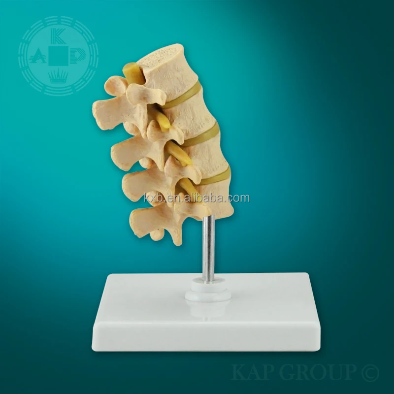 A01-023 Plastic Medical Human Spine Anatomical Model / Artificial ...