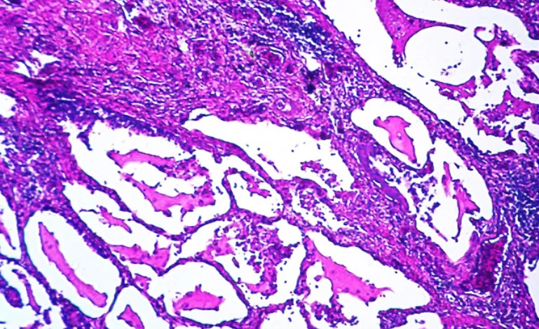 200pcs Human Pathology Slides Set,Pathological Prepared Slides ...