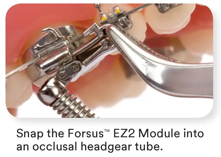 Unitek Forsus Class Ii Correctors/forsus Fatigue Resistant Device Ez2 ...