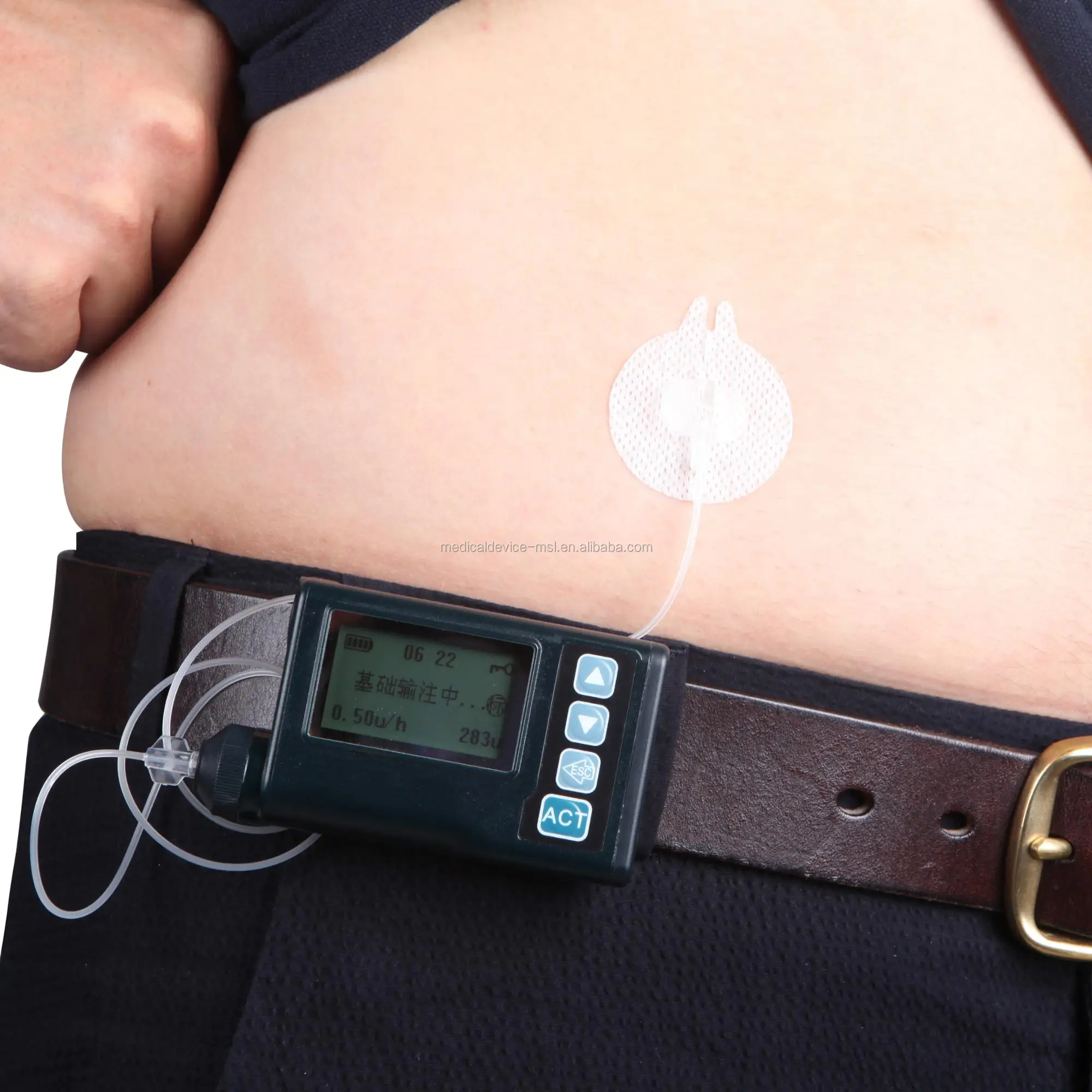 Guangzhou Portable Insulin Pump For Diabetics/handheld Infusion Insulin ...