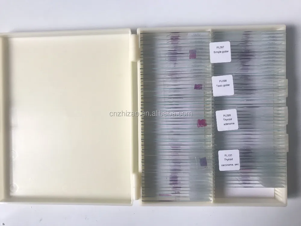 100pcs Human Disease Pathology Slides - Educational Tools
