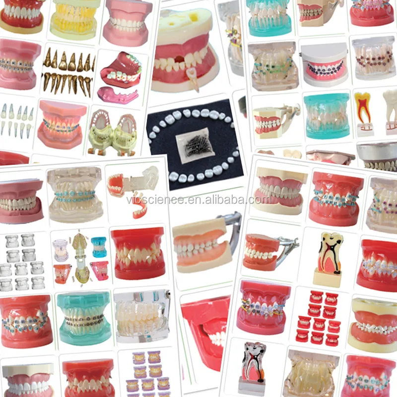Full Denture Implant Model For Study Medical Science Human Teeth Model ...