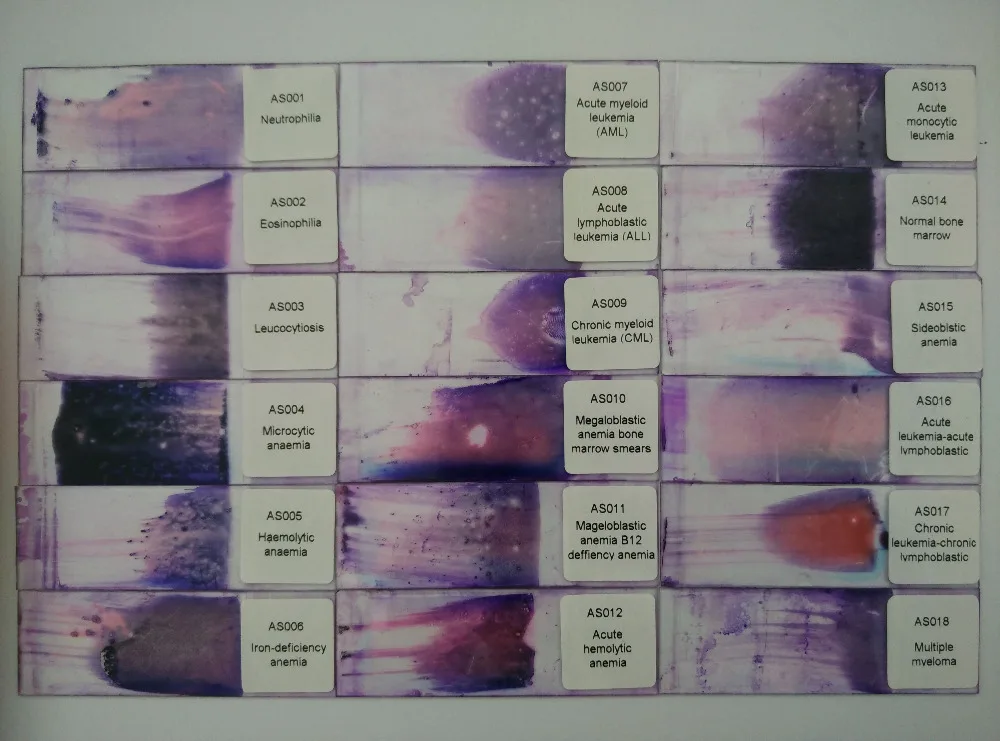 18pcs Hematology Prepared Slides Blood Smear Prepared Slides - Buy ...