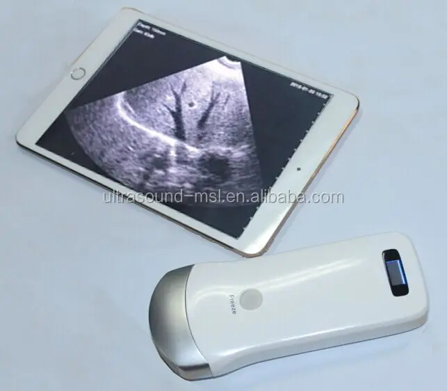 MSLPU31F - Advanced Wireless USG Ultrasound Probe for Pregnancy