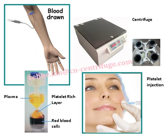 Beauty Prp Centrifuge Blood Plasma Separation Machine With 20cc,30cc ...