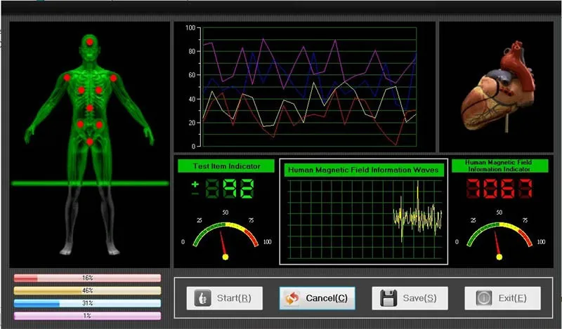 Polish 45 Report Quantum Biofeedback Machine Health Analyzer With Free ...