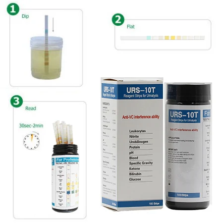 10 Parameter Urine Test Strips - Reliable in-Vitro Analysis