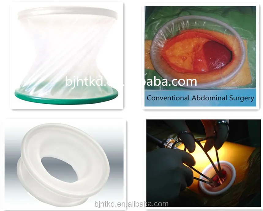 Disposable Wound Protector Surgical Incision Protector With CE hospital ...